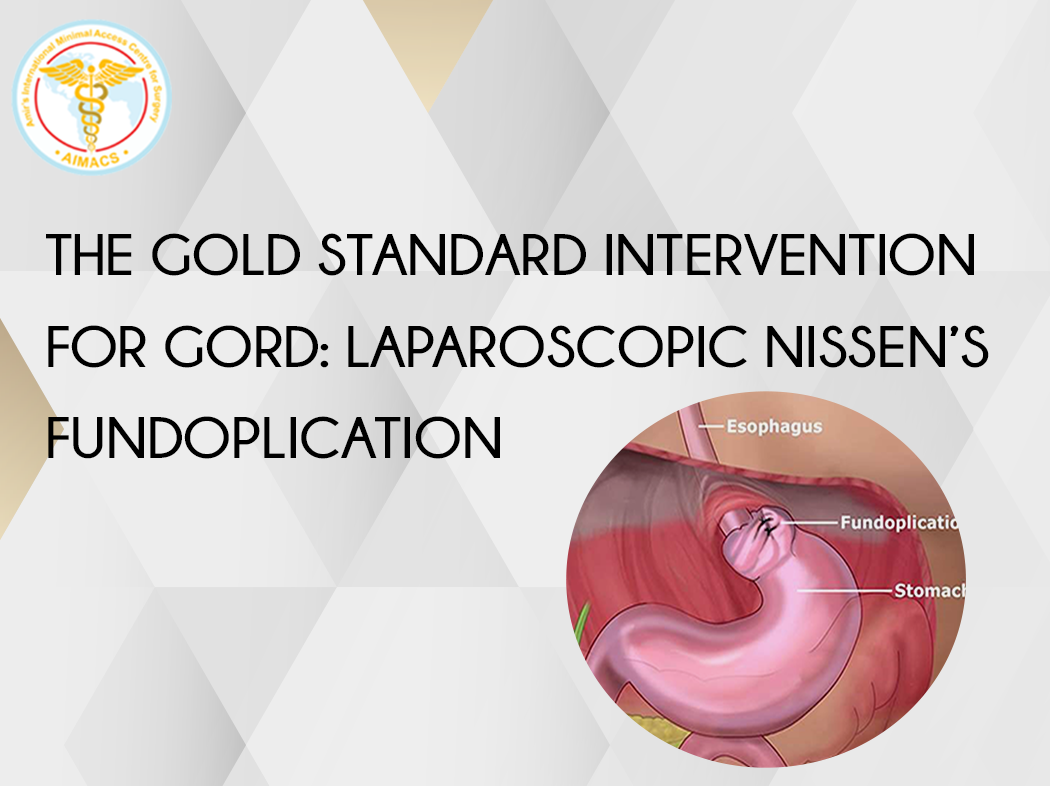 The Gold standard Intervention for GORD: Laparoscopic Nissen’s ...