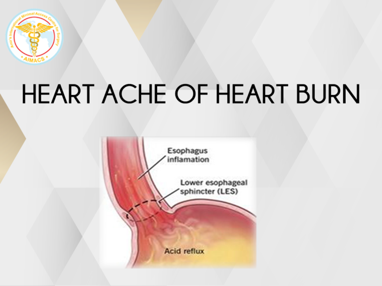 Heart Ache of Heart Burn – Professor Amir Nisar