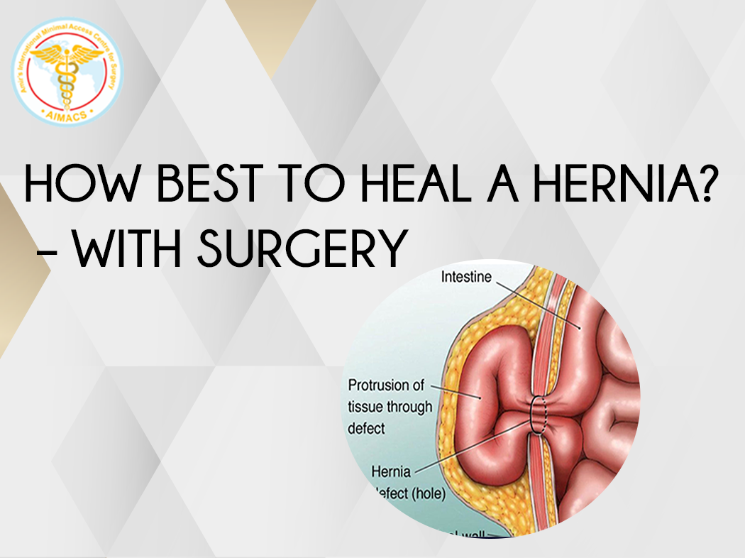 How best to Heal a Hernia? – with Surgery. – Professor Amir Nisar