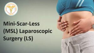 Recovery after Laparoscopic Cholecystectomy. What to expect ...