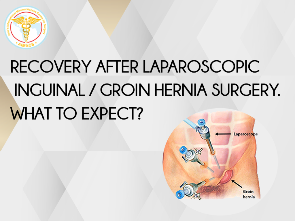 Hernia Surgery Recovery